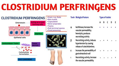 Clostridium Perfringens Pathogenesis