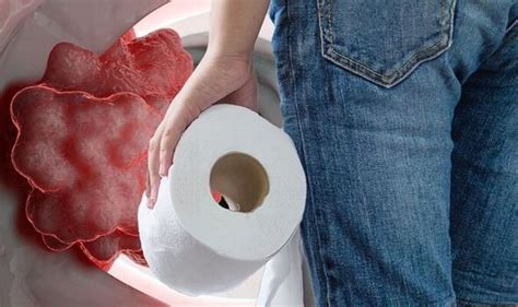 Cancer Womans Bowel Obstruction While On Holiday Led To Terminal