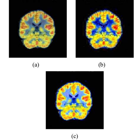 The Outputs Of Different Fusion Methods Pca A Wavelet B Proposed Download Scientific