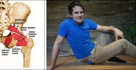 Do You Have Trigger Points In Your Buttocks • Wholebodychiro