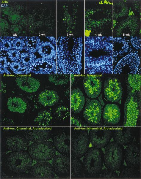 Developmental Expression Of Arc Protein In Mouse Testis Sections From Download Scientific