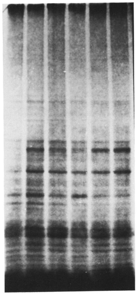 Densitometric Scans Of The [3ss]methionine Labeled Translation Products