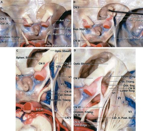 Cavernous Sinus Netter