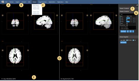 The Dual Viewer Application Bisweb Manual