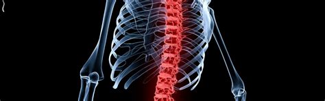 Hemangioma Spine Causes Symptoms And Treatment