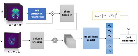 A Self Attention Model For Robust Rigid Slice To Volume Registration Of