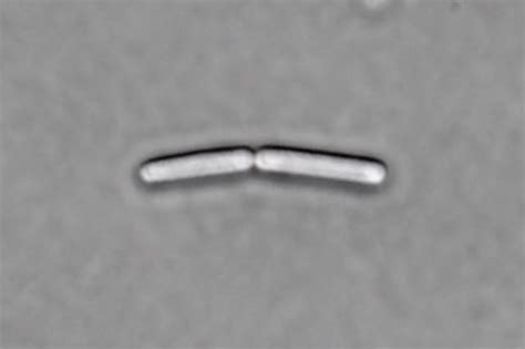 Bacteria R Microscopy