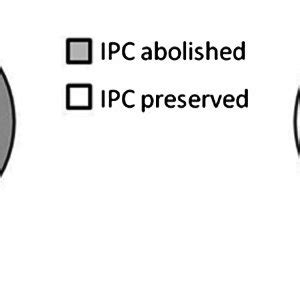Pie Charts Showing The Number And Percentage Of Patients With IPC Download Scientific Diagram