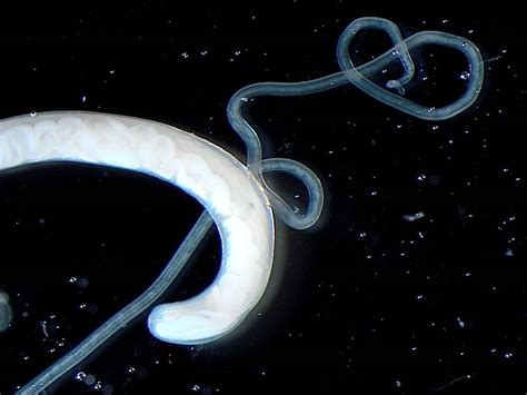 Pathology Outlines Whipworm
