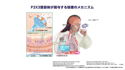病態｜慢性咳嗽 Library