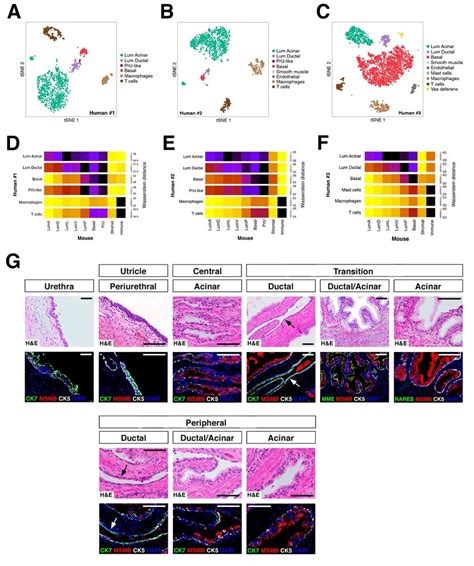 Source Data Human Prostate Samples And Corresponding Clinical Data