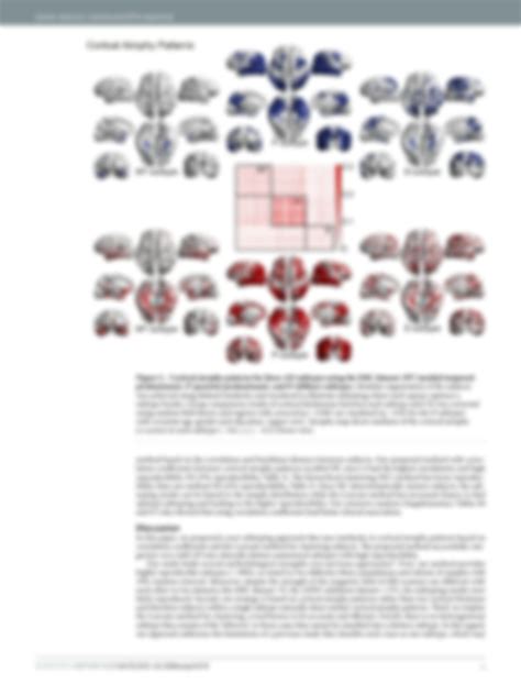 Solution Robust Identification Of Alzheimer S Disease Subtypes Based
