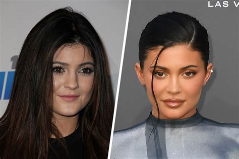 Кайли Дженнер заявила что никогда не прибегала к услугам пластического хирурга Газета Ru