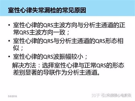 正确解读动态心电图及动态心电图的应用 知乎