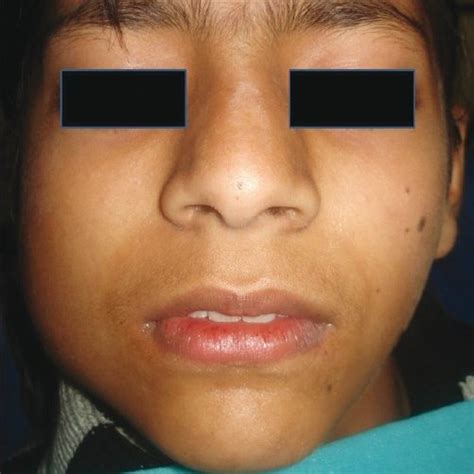 Classification Of Hyperparathyroidism Download Scientific Diagram