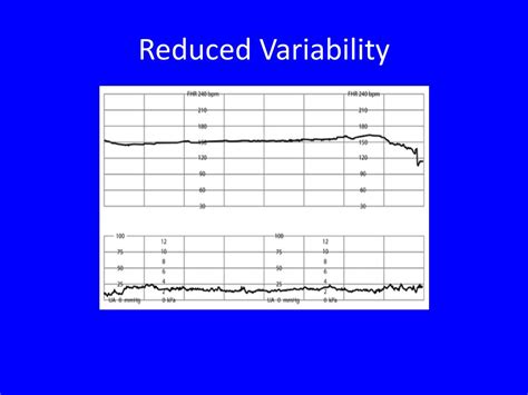 Ppt Ctg Interpretation And Management Powerpoint Presentation Free Download Id 6405393