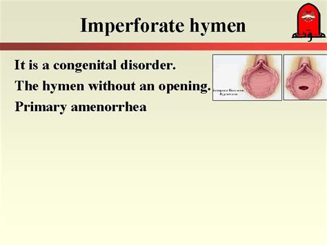 Pathophysiology L 11 Female Genital System Prof Fakhir