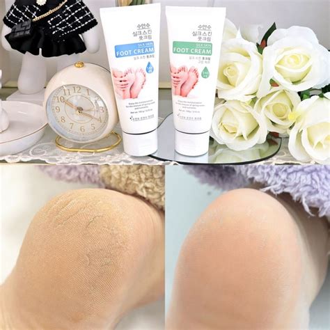 에네스티 온천수풋크림 발바닥 And 발각질완화 후기 네이버 블로그