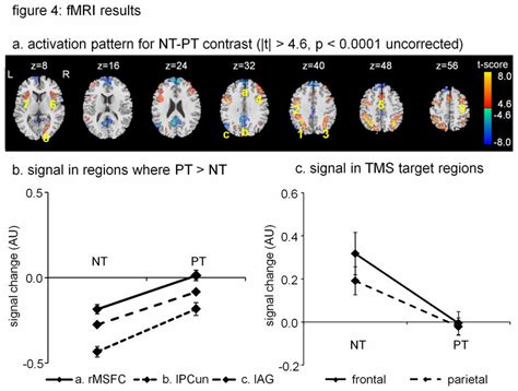 Summary Of The Fmri Results A Regions Showing Significant Difference Download Scientific