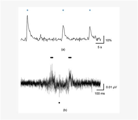 Brain Function 903x632 Png Download Pngkit