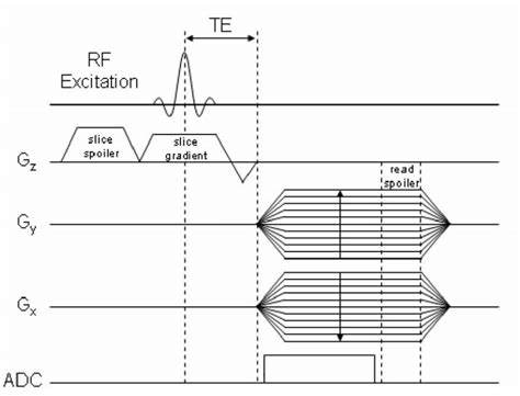 1 Pulse Sequence For A Radial Ute Trajectory With Fid Acquisition