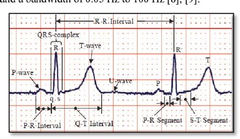 Figure 1 From An Fpga Based Mpsoc For Real Time Ecg Analysis Semantic