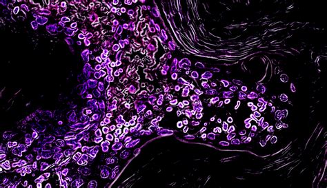 10x Sequencing An Overview And Case Studies