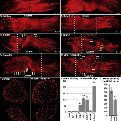 Axon Guidance Defect In Slit3 And Robo1 Gene Mutant Mice Whole Sciatic