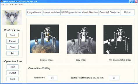 icm segmentation interface of our biological imaging guidance