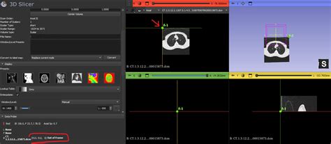 Probe Position And Ijk Ras Coordinates Support 3d Slicer Community