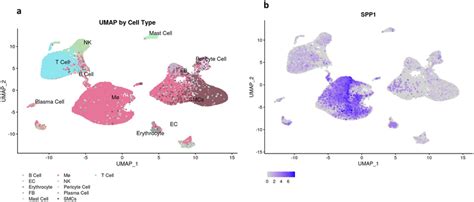 Single Cell Genomic Analysis Of Spp1 Expression In Plaqview 20