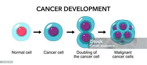 암 발병 정상 세포는 암으로 변형됩니다 건강한 세포의 유전적 돌연변이에서 악성 암세포로의 발암 돌연변이 유발 종양 발생 종양 형성 종양 형성 0명에 대한 스톡 벡터 아트 및
