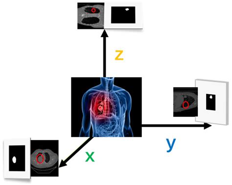 electronics free full text efficient lung cancer image