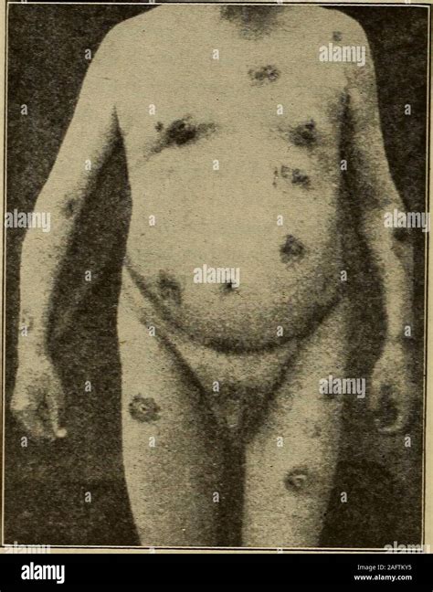 Medical Diagnosis For The Babe And Practitioner Fractile Membrane Mode Of Entrance It