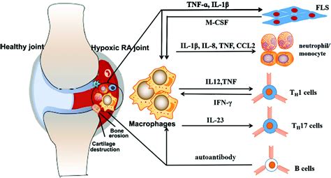 Rheumatoid Arthritis Treatment Natural