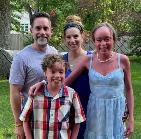 Foundation For Ichthyosis And Related Skin Types Inc First On Linkedin Ichthyosis