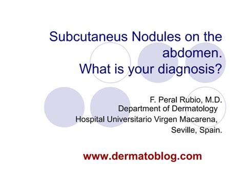 Subcutaneous Nodules On The Abdomen Ppt Skin And Dermatology Diseases And Conditions