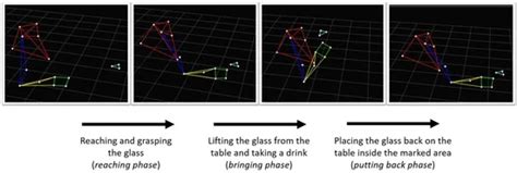 Article Effects Of Upper Limb Robot Assisted Rehabilitation Compared With Conventional Therapy