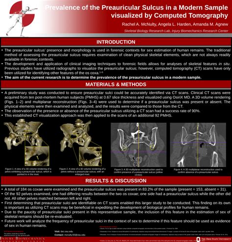 Pdf Prevalence Of The Preauricular Sulcus In A Modern Sample Visualized By Computed Tomography