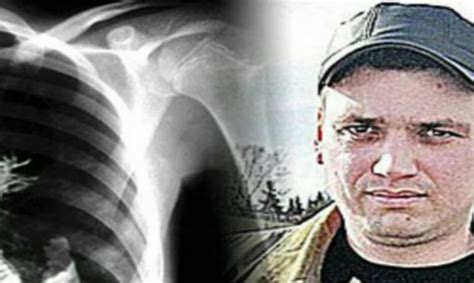 Shocking A Tree Growing Inside Human Body