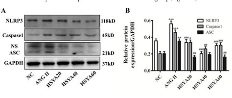 Figure 2 From Hydroxysafflower Yellow A Inhibits Vascular Adventitial Fibroblast Migration Via