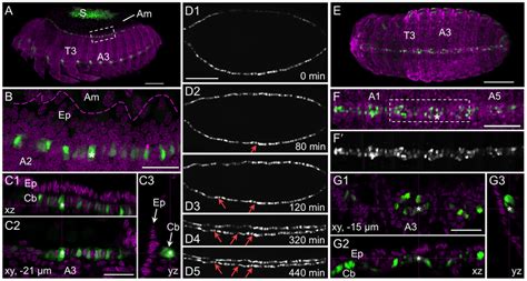 Mesodermal Expression In The Line G04609 Heart Anatomical Details For