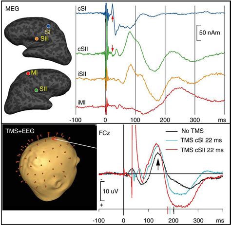 Figure 1 From Probing Cortical Excitability With Transcranial Magnetic Stimulation Semantic