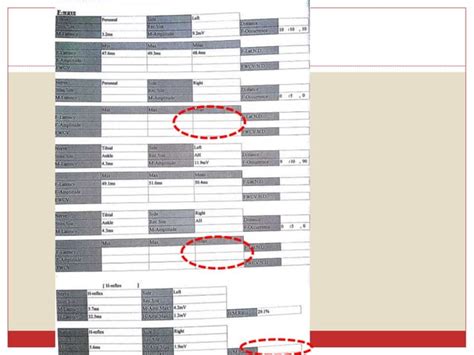 Electrodiagnostic Approach To Peripheral Neuropathy Pptx Brain And Nervous System Disorders