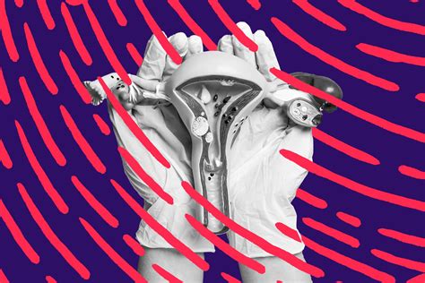 Incompetent Cervix Why Are Names For The Female Reproductive System So