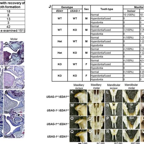 pdf anti usag 1 therapy for tooth regeneration through enhanced bmp signaling