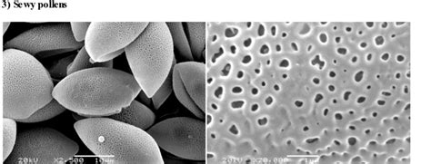 Hiani Pollen Shape And Size X 2500 Fig 4 Hiani Pollen Surface X Download Scientific
