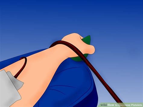 How To Decrease Platelets 12 Steps With Pictures Wikihow