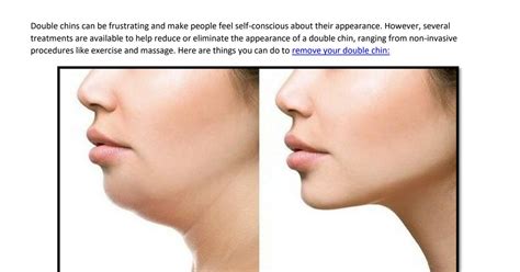Transform Your Look By Removing Your Double Chin At Home By Double Chin Removal Wand Issuu
