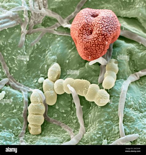 Rust Fungus Spore Coloured Scanning Electron Micrograph SEM Of A Spore Reproductive Cell Of
